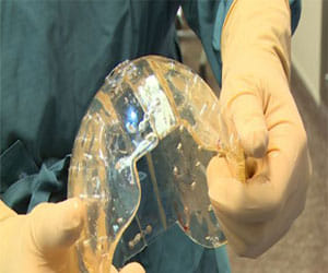 हैरतअंगेज! इस महिला की खोपड़ी है प्लास्टिक की! - Women Undergoes Skull ...