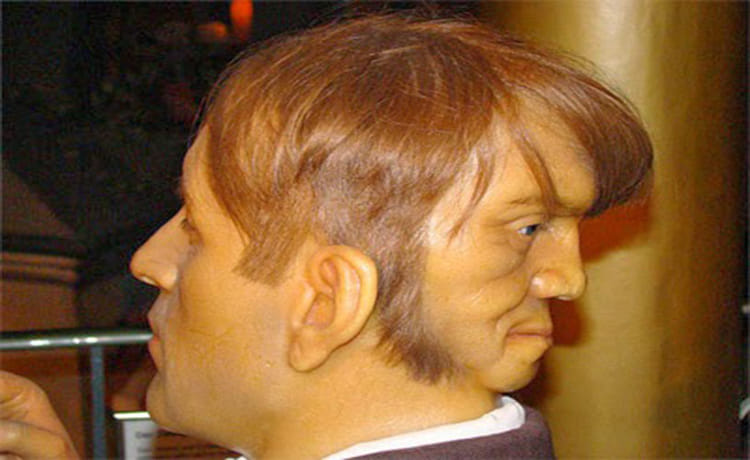 The Disturbing True Story Of Edward Mordrake - Amar Ujala Hindi News ...