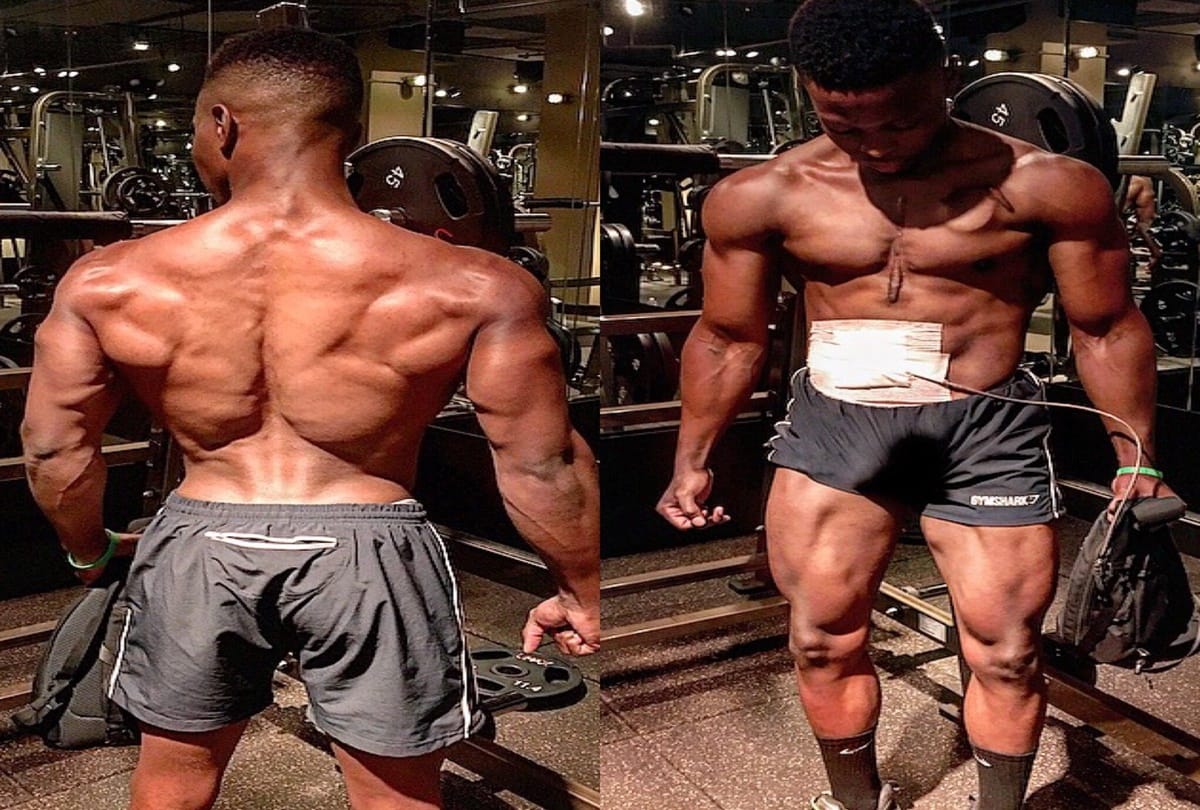 Meet Andrew Jones The Fitness Model And Bodybuilder Without A Pulse ...