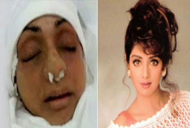 Sridevi Dead Body First Photo See Here - Entertainment News: Amar Ujala ...