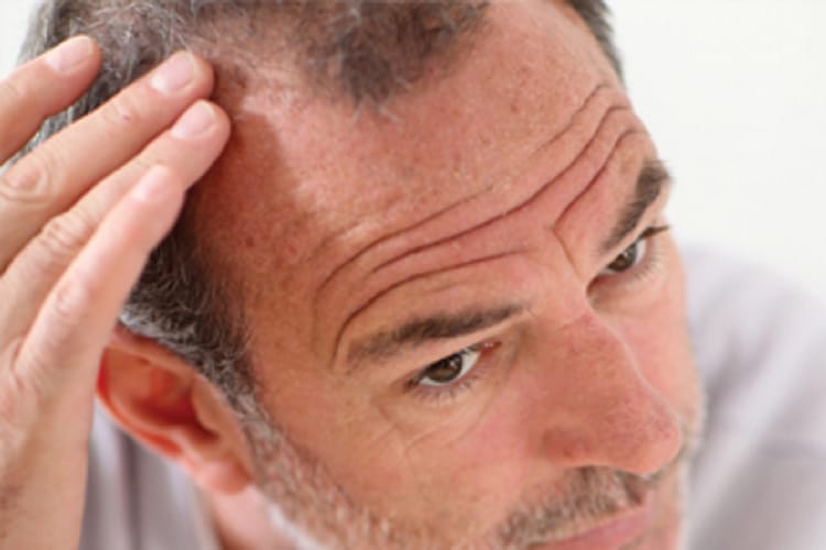 Know The Person From The Forehead These Marks Are Auspicious - Amar ...