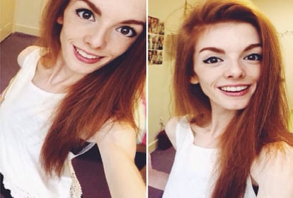 England Girl Annie Windley Body Weight Was Low Abnormally Because Of ...