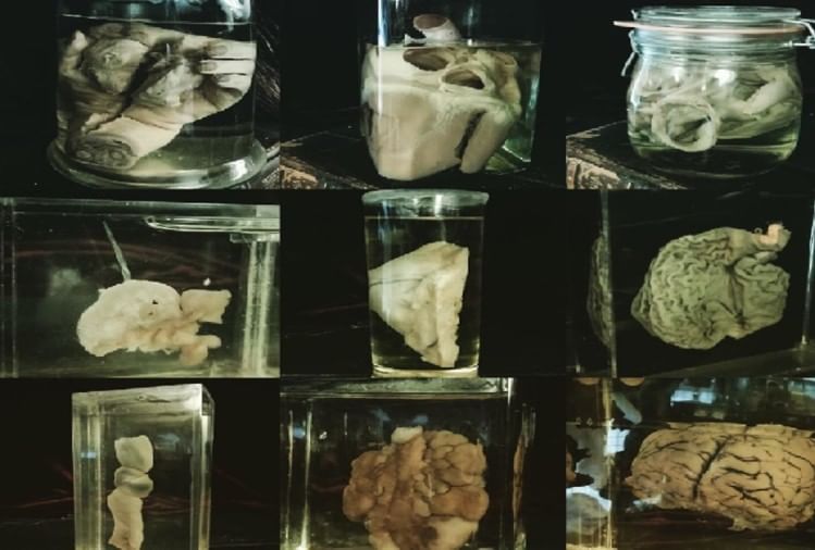 यह शख्स बेचता है इंसानी अंगों का अचार, लाखों रुपये में खरीदते हैं लोग ...