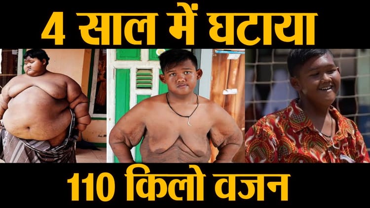 पतला हुआ दुनिया का सबसे मोटा बच्चा, 4 साल में घटाया 110 किलो वजन ...