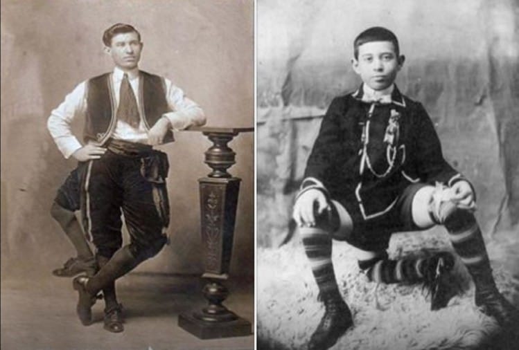 अजब-गजब:कहानी तीन टांगों वाले एक शख्स की, जो 77 सालों तक लोगों के बीच ...