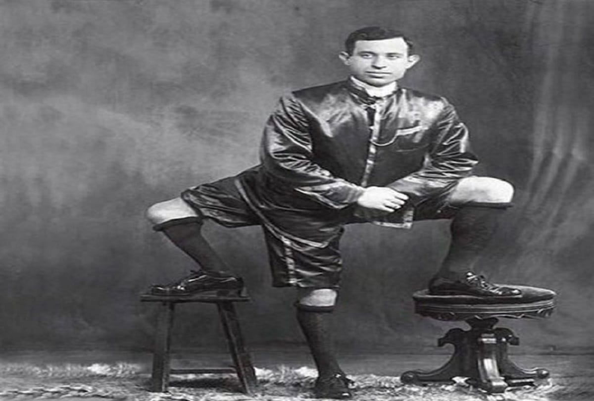 Interesting Story Of Three Legged Man Frank Lentini - Amar Ujala Hindi ...