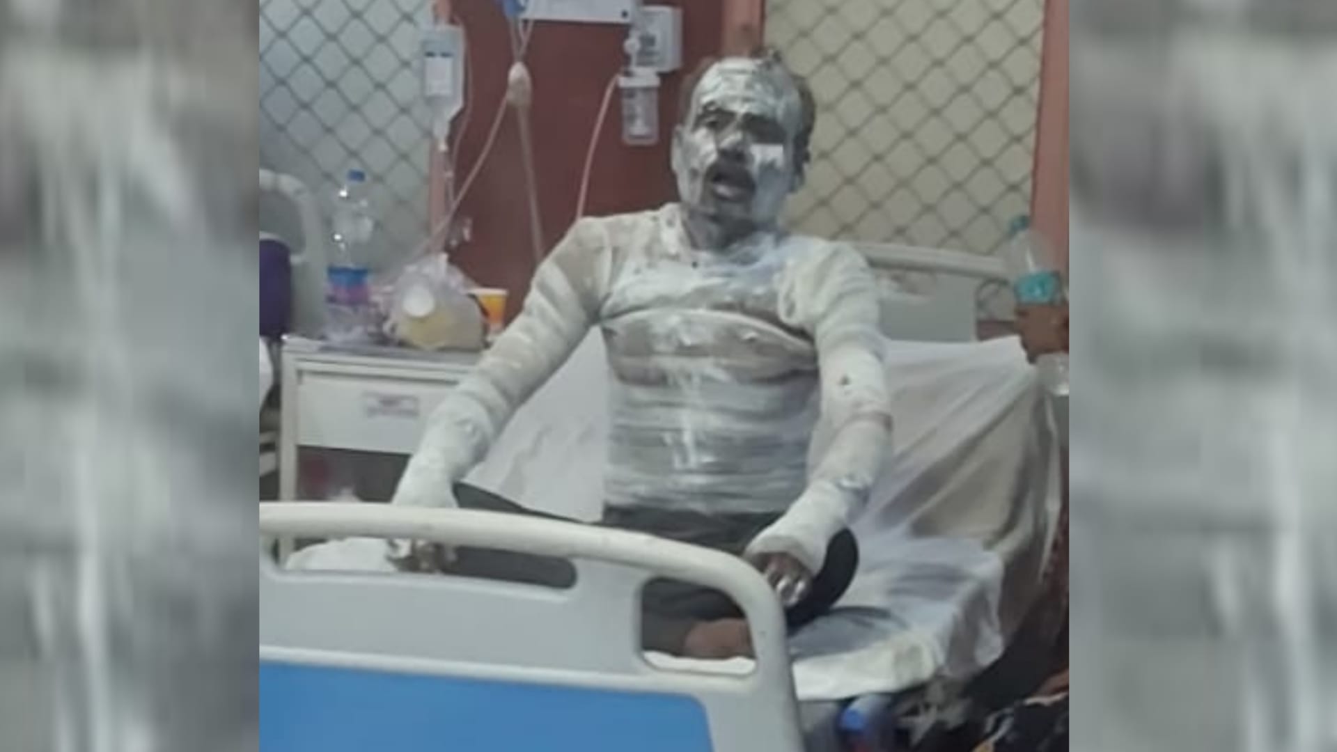 A Man Self Immolated Near Bjp Office Gate In Lucknow. - Amar Ujala ...