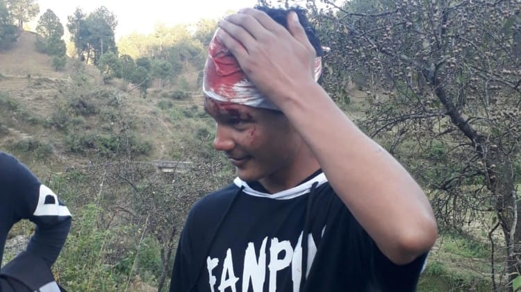 उत्तराखंड:पत्थर युद्ध देख थम गईं लोगों की सांसें, रणबाकुंरों ने की एक ...