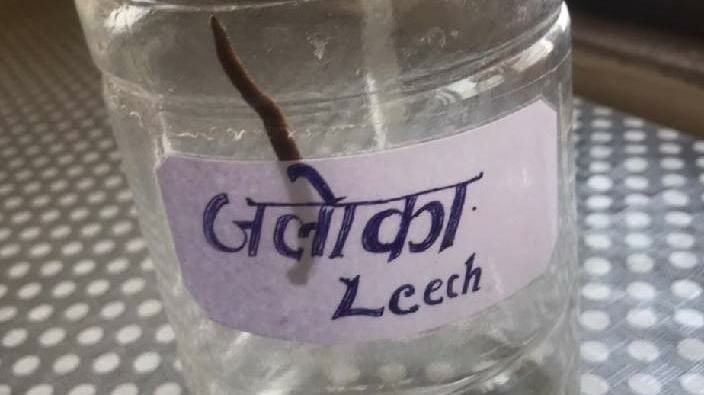 Leech Therapy:बीएचयू में जलौका केंद्र में होगा जोंक थेरेपी से उपचार ...