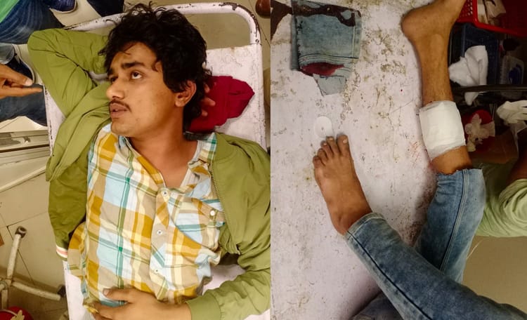 Police Arrested Two Murder Accused In Jind After Encounter - Amar Ujala Hindi News Live - Jind ...