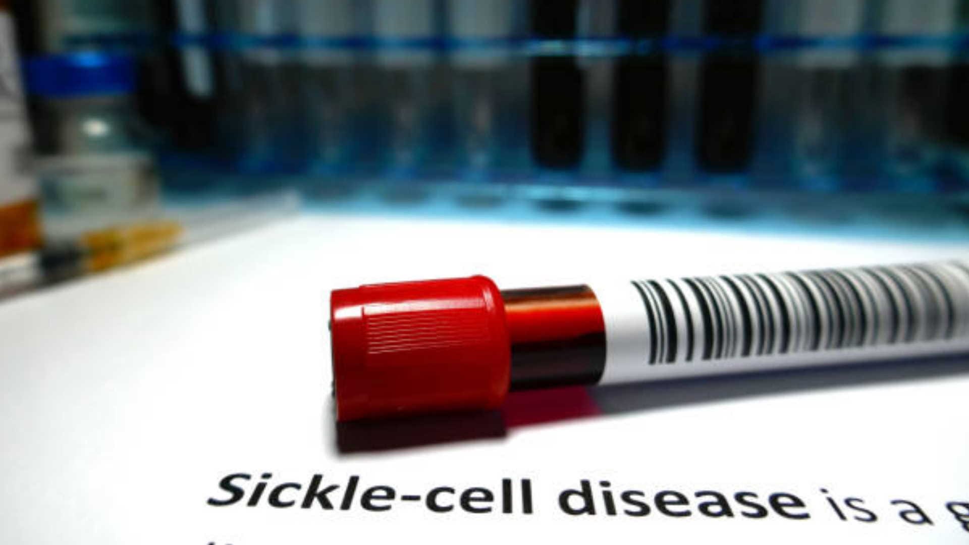 Sickle Cell Disease:2047 तक देश से सिकल सेल रोग के खात्मे की दिशा में ...