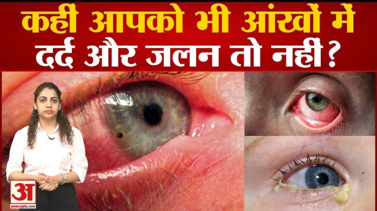 Eye Flu Continues To Wreak Havoc, Know What Are The Symptoms And ...