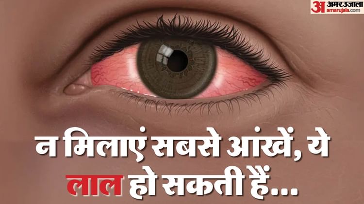 Eye Flu Patients Increased Rapidly Problem May Be Serious In 30 Percent Aiims Issued Guidelines ...