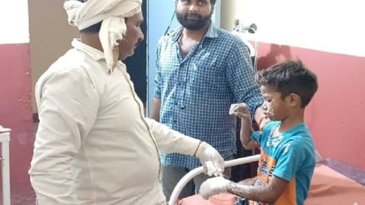 Firecracker Exploded In Hand While Bursting Child's Two Fingers ...
