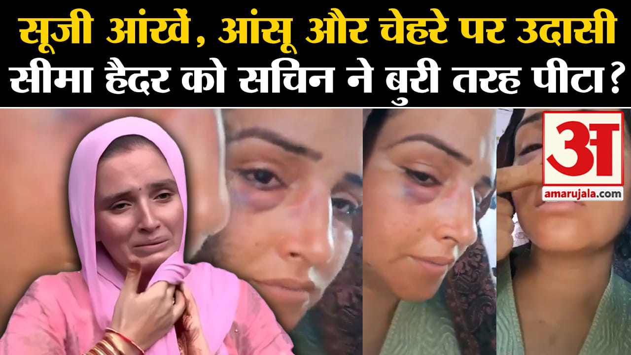 Sachin Beat Seema Haider Badly? Seema Haider Showed Injury Marks On Her ...