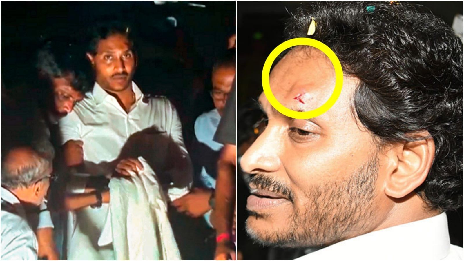 Andhra Pradesh Cm Jagan Mohan Reddy Injured In Stone Pelting Incident During Vijayawada Road ...