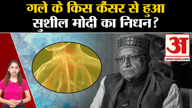 Sushil Kumar Modi Death: What Is Esophageal Cancer Due To Which Sushil ...