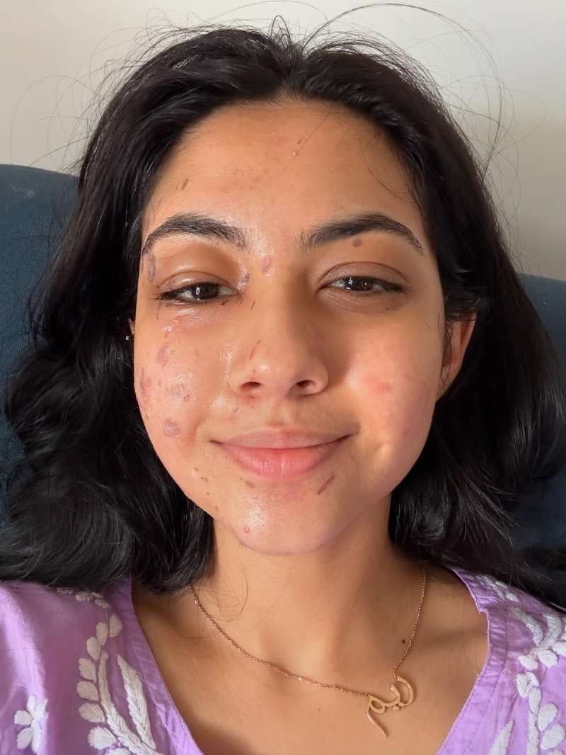 मुंह पर चोटों के निशान, सूजी आंखें...रीम शेख की हालत ने किया दंग