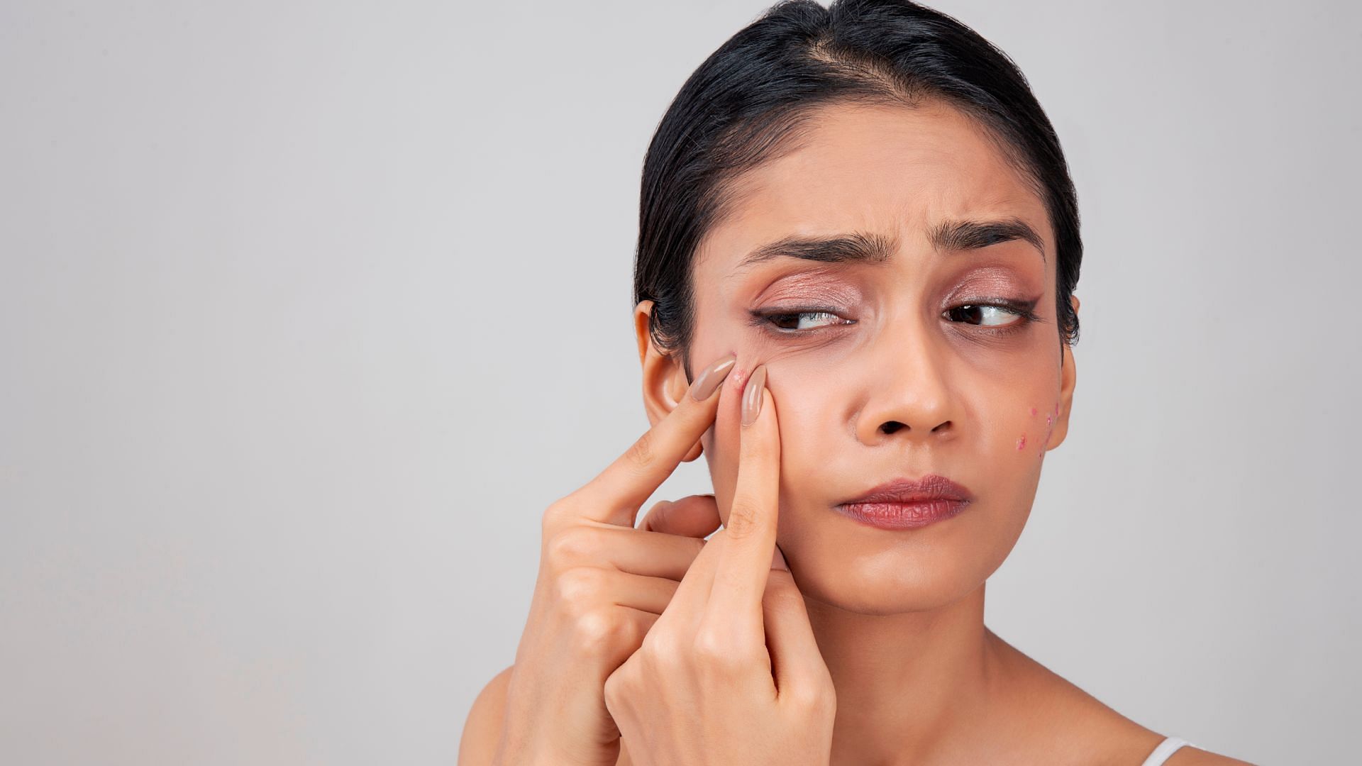 How To Remove Pimple In Easy Way In Hindi Amar Ujala Hindi News Live