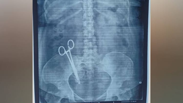 Doctor Of Private Hospital Left Scissors In Stomach Of Women In Lucknow ...