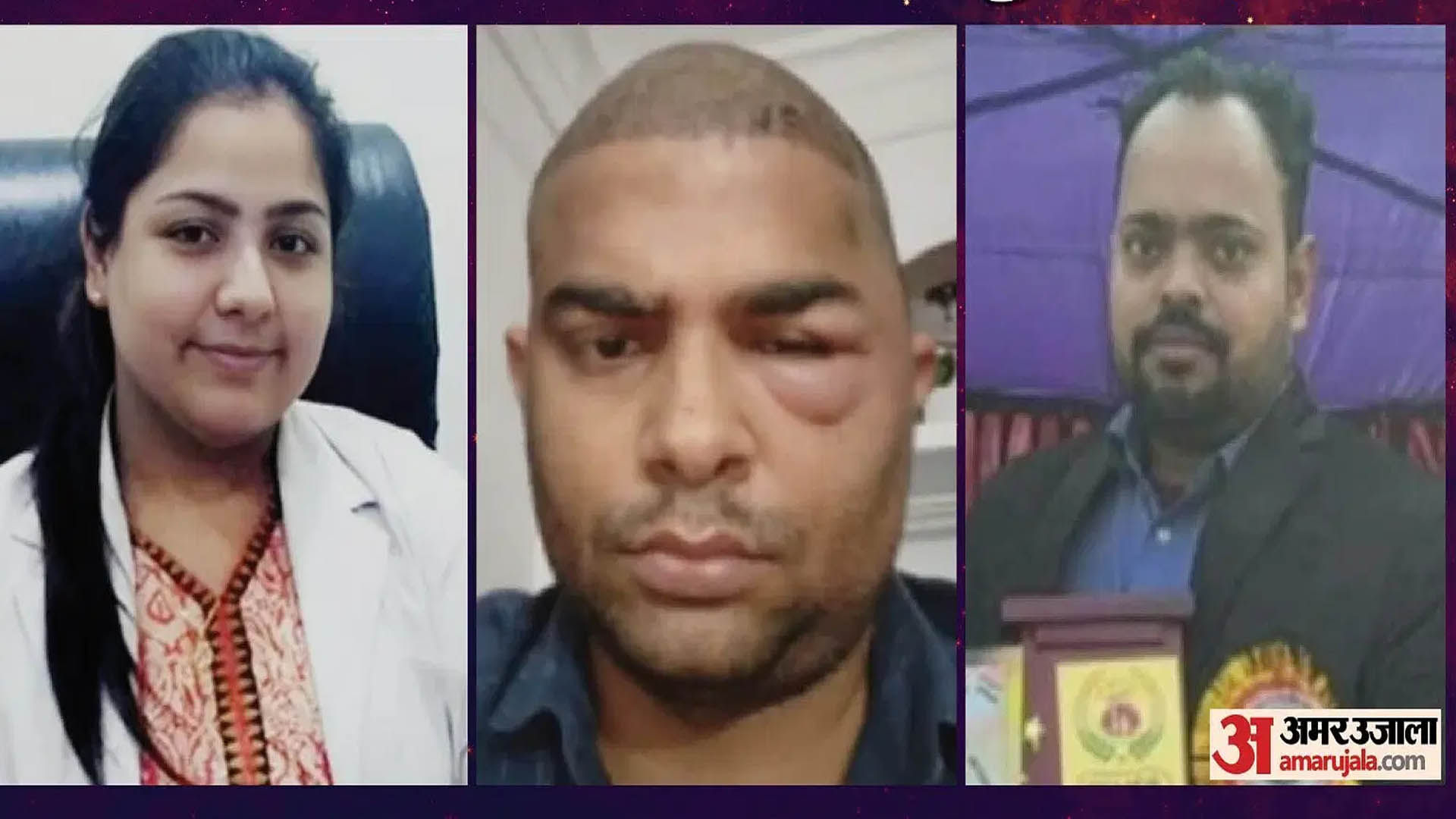 Kanpur Hair Transplant Case Swelling In Head Face Blue Blood Sugar 350 New Revelation In Post ...