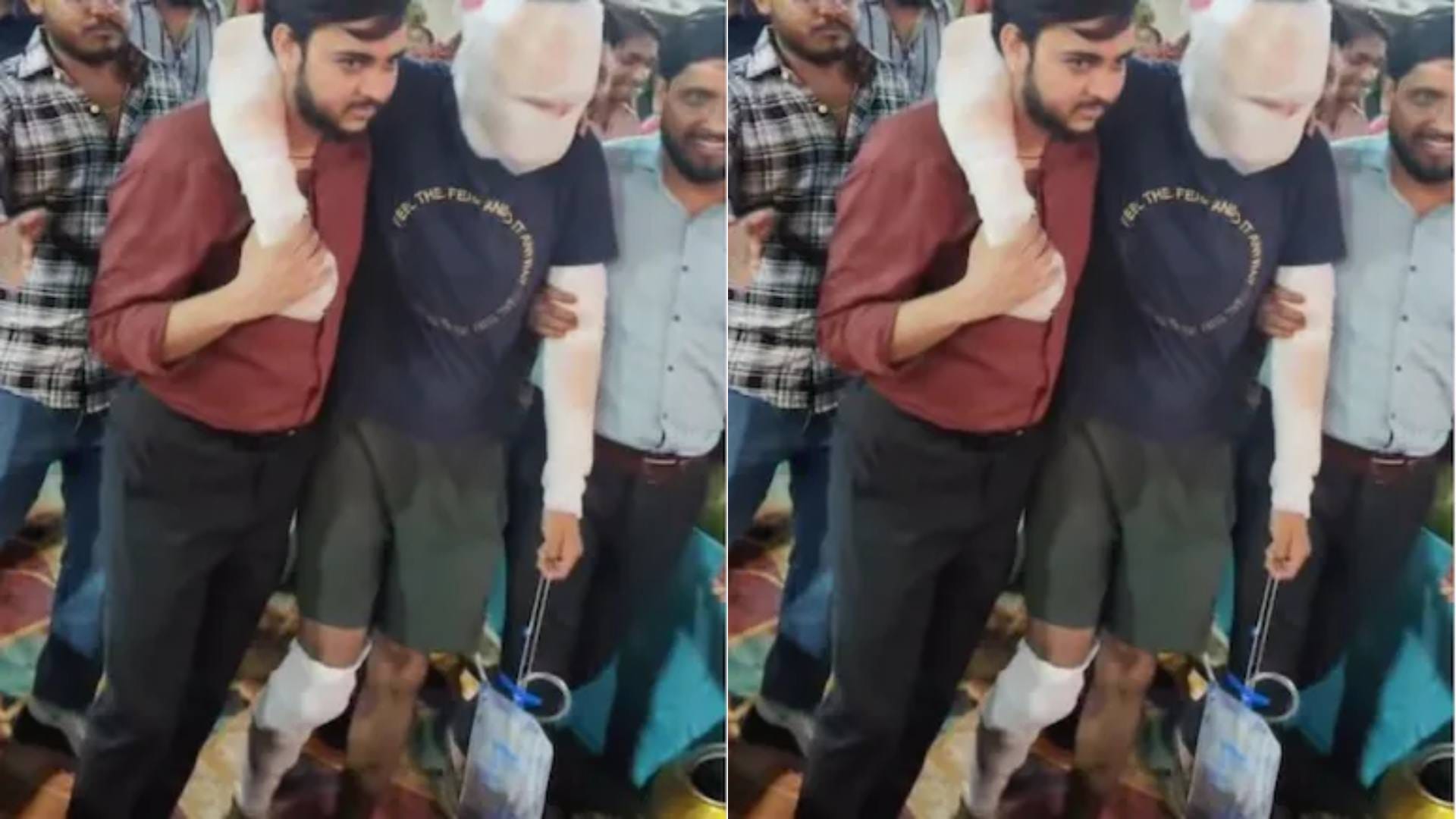 A Boy Reached His Friends Wedding With A Bandage On His Head And ...