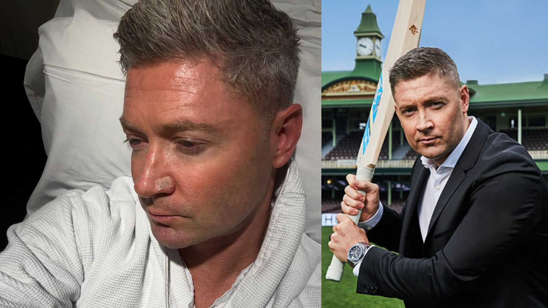 Michael Clarke:स्किन कैंसर से जूझ रहे माइकल क्लार्क की हुई छठी सर्जरी ...