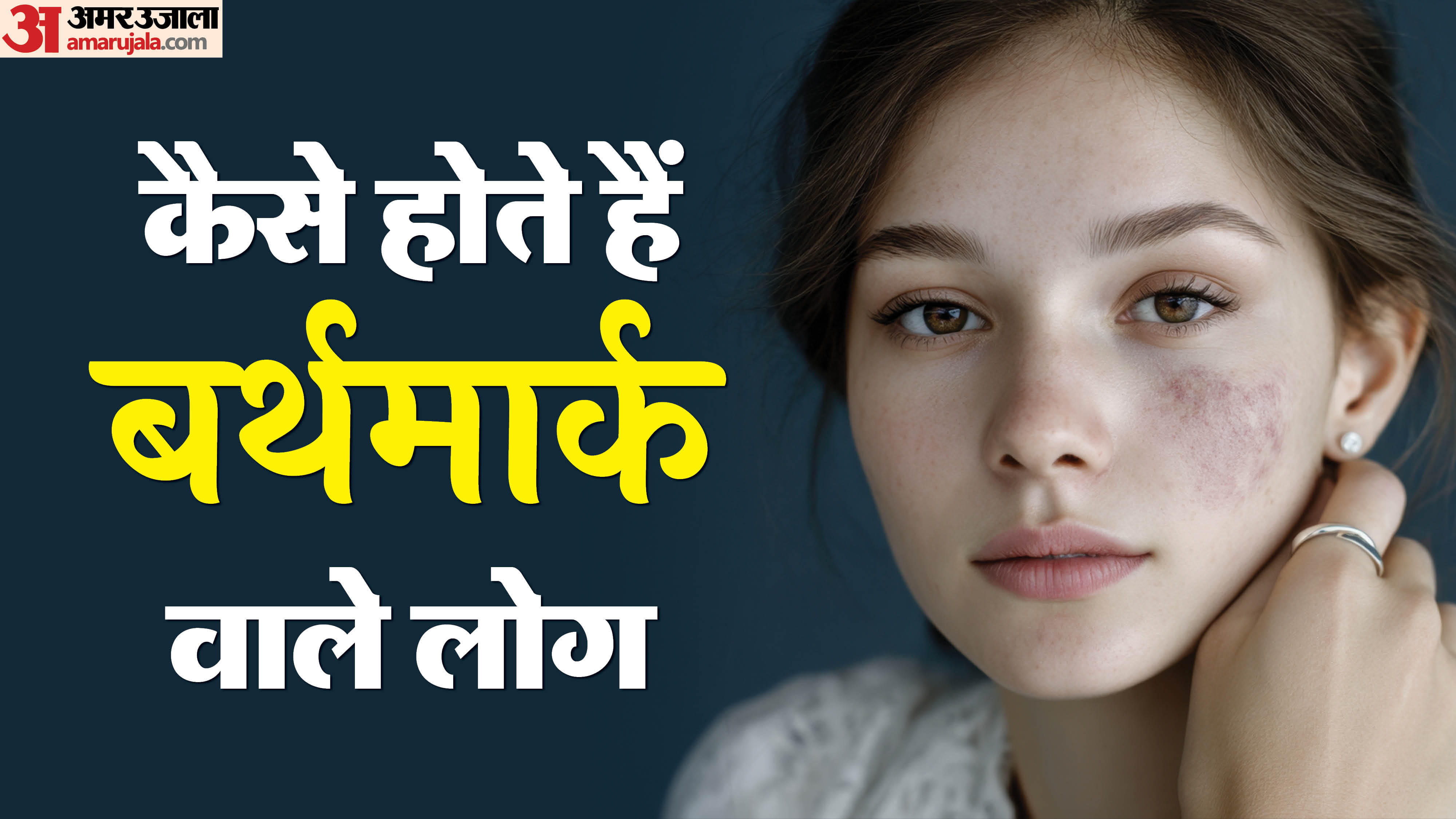 Birthmarks:जन्म से शरीर पर निशान होने के होते हैं कई अर्थ, जानें क्या ...