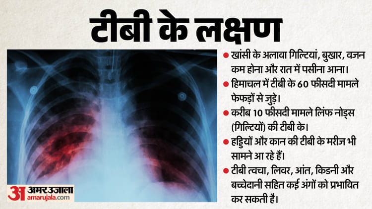 स्वास्थ्य:हिमाचल में कान और हड्डियों की टीबी के मरीज भी आ रहे सामने, 60 ...
