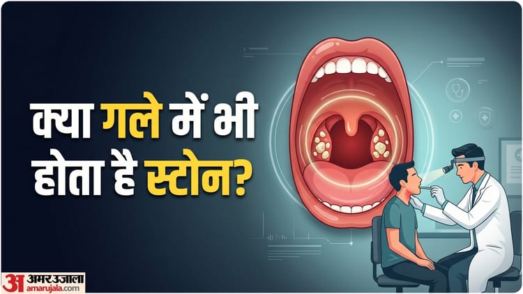 Tonsil Stones:सिर्फ किडनी-गॉलब्लैडर ही नहीं, आपके गले में भी हो सकती है ...