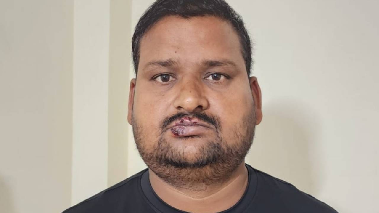 Up:प्रॉपर्टी डीलर संदीप सिंह हत्याकांड में बड़ा खुलासा, शूटरों की ...