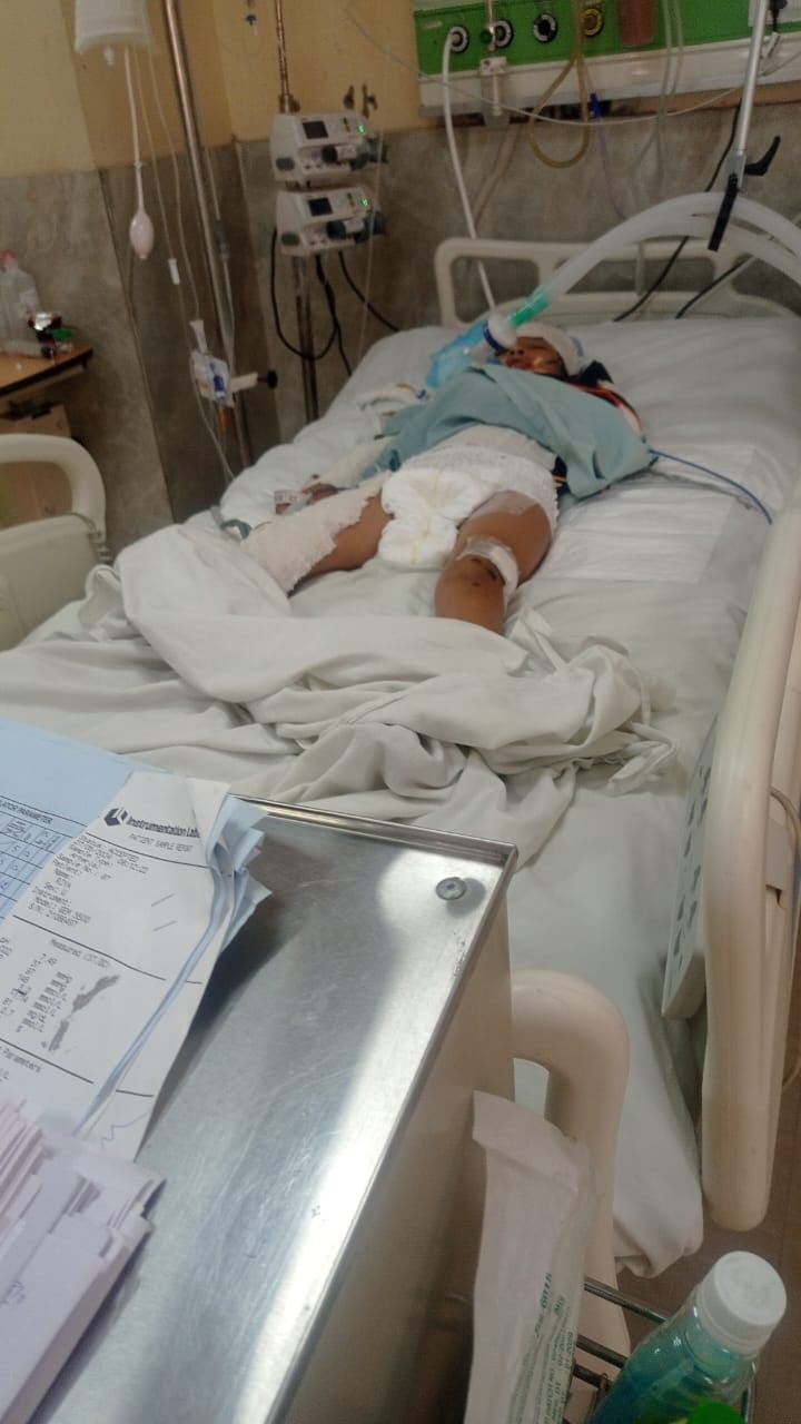Vishal Injured In Accident Admitted In Icu - Ambala News - Ambala News:हादसे में घायल विशाल ...