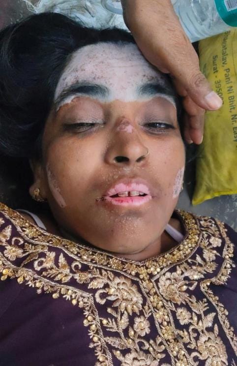 Bike Rider Fell After Getting Stuck In Barbed Wire - Bahraich News ...