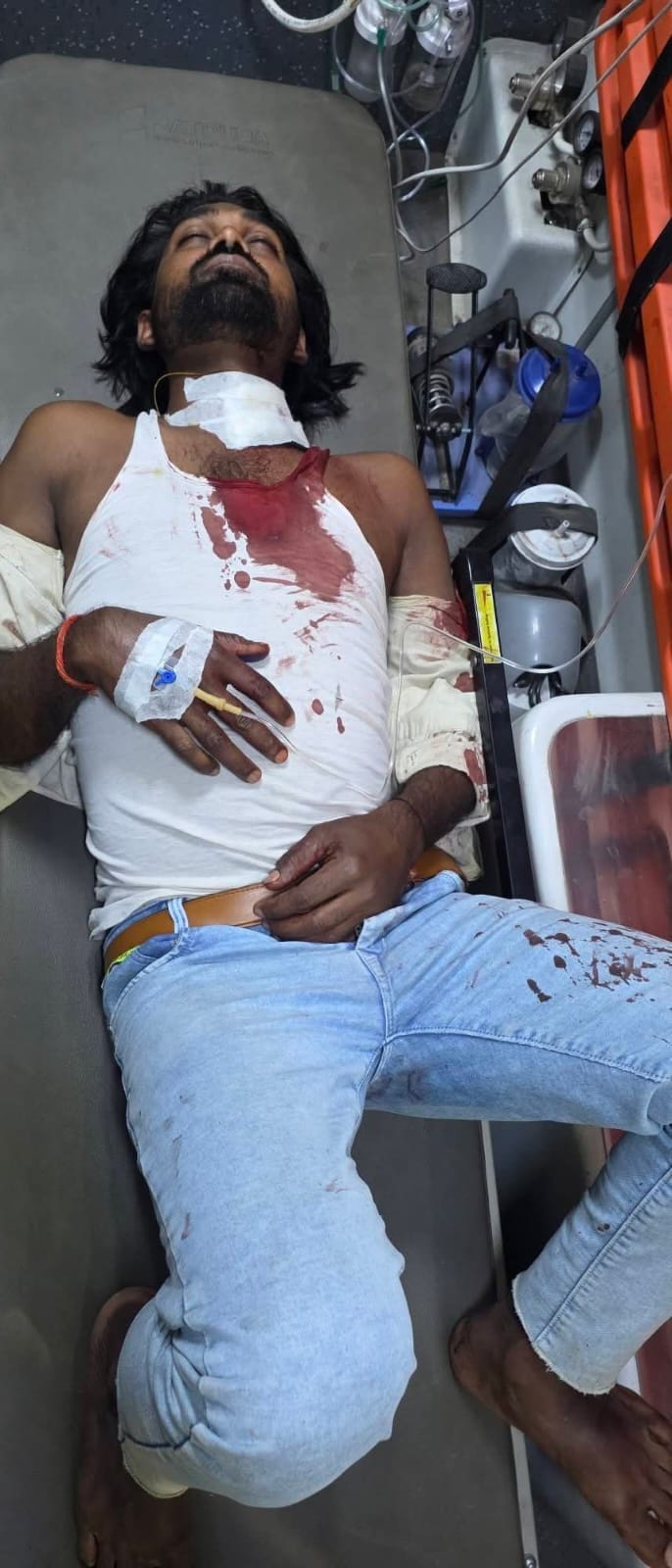 Firing During Dj Dance, Bullet Hit Young Man Below Neck - Pilibhit News ...