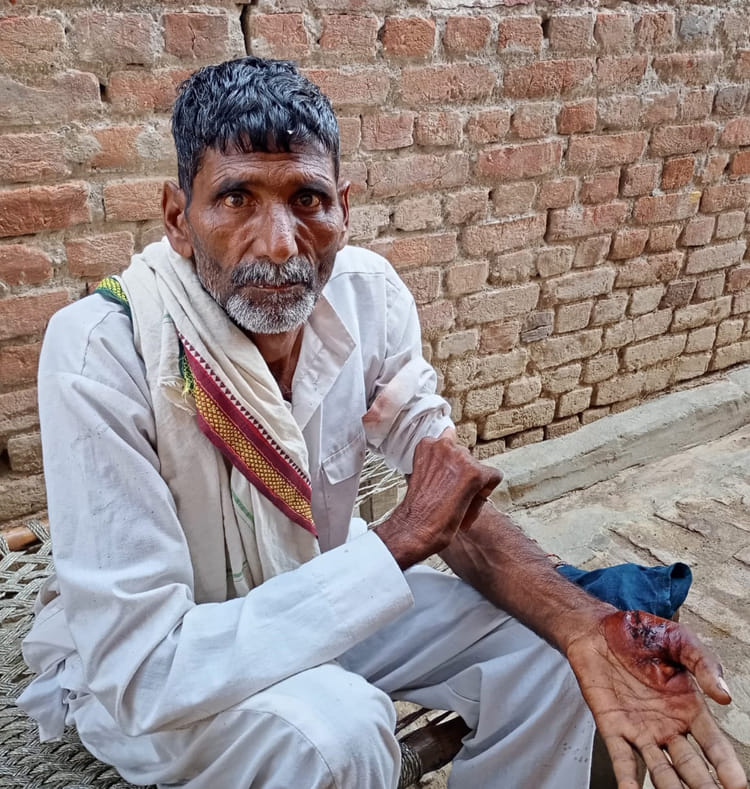 Jackal Injures Farmer Guarding Maize Crop. - Budaun News - Budaun News ...