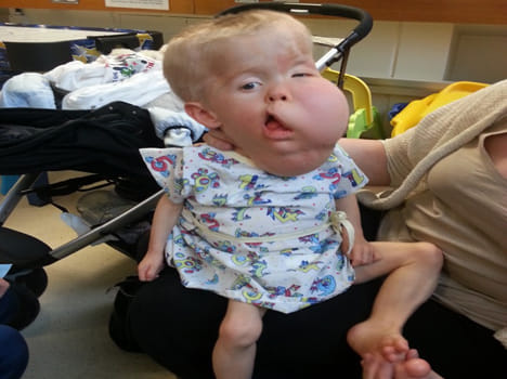 Rarest Baby In The World - Amar Ujala Hindi News Live - दुनिया का सबसे ...